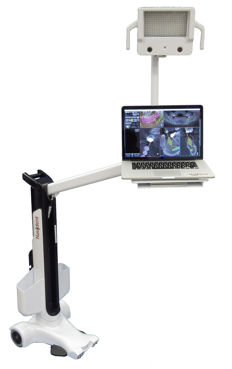 Etgar Medical Implant Systems » Navident